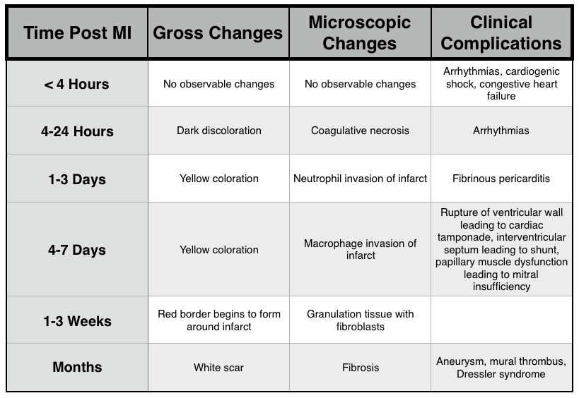 Complications Of Myocardial Infarction MEDizzy