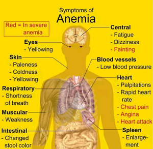 Symptoms of Anemia - MEDizzy