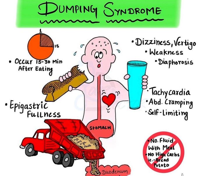 Dumping Syndrome - MEDizzy