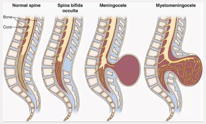 Spinal Pathologies - MEDizzy