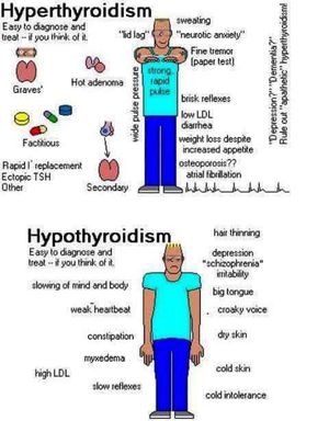 Hyperthyroidism vs hypothyroidism - MEDizzy
