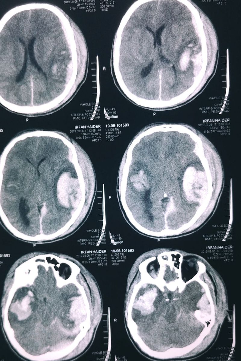 Positive Findings? - MEDizzy