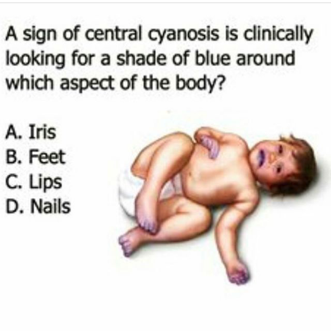 Comment Ur Answer if U know. Plzz comment - MEDizzy