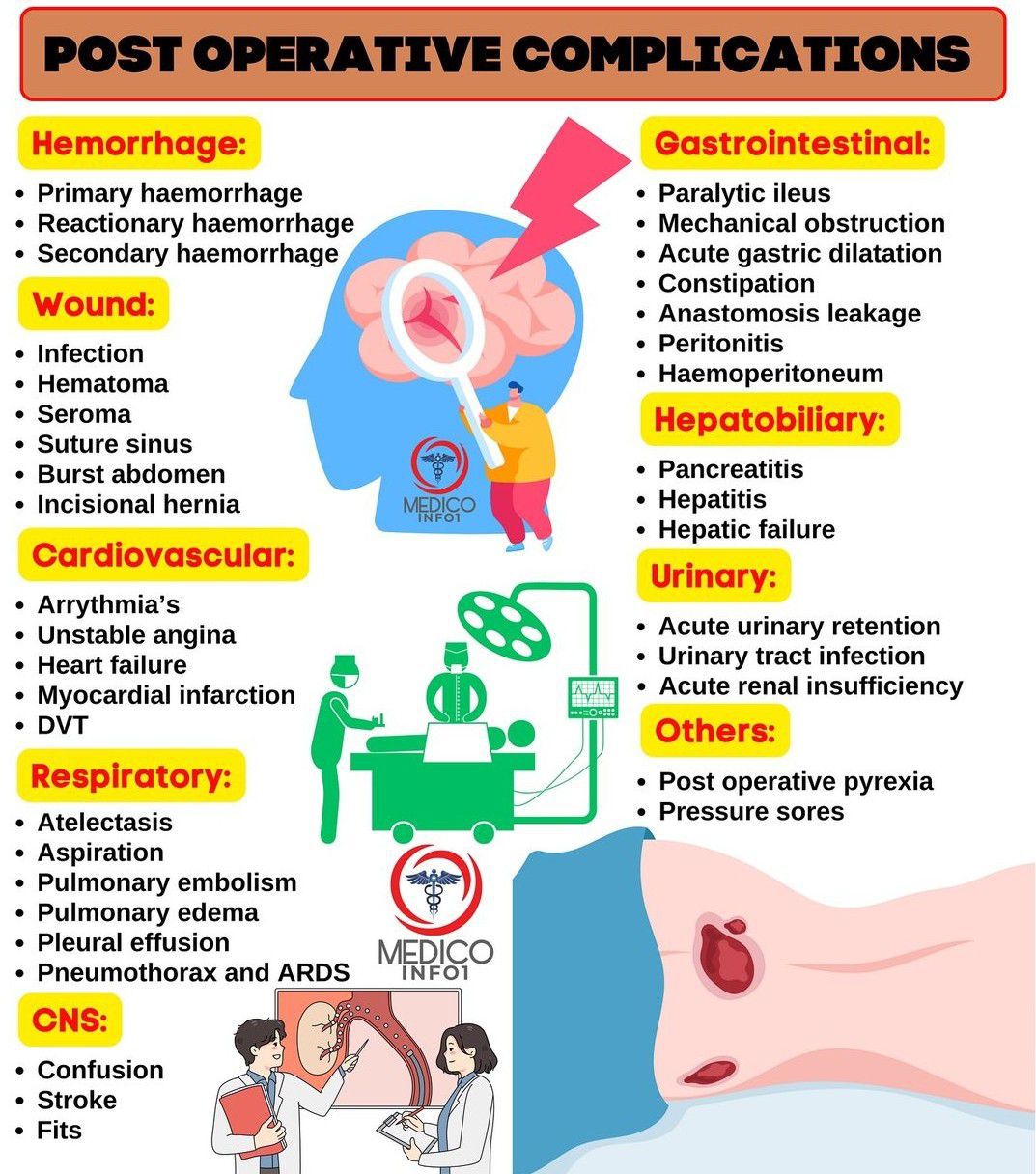 Post Operative Complications MEDizzy