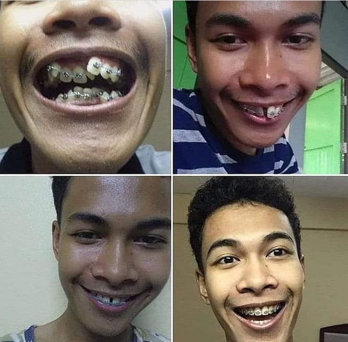 Amazing Transformation - MEDizzy