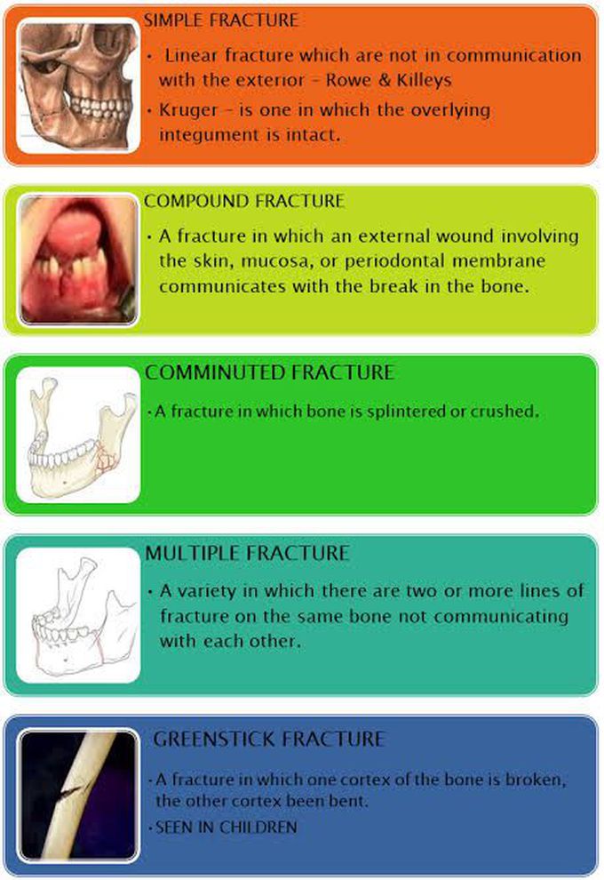 Mandibular Fracture - Types - MEDizzy