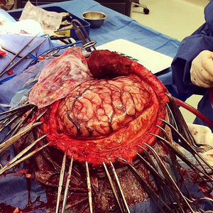 Neurosurgery is just too cool. - MEDizzy