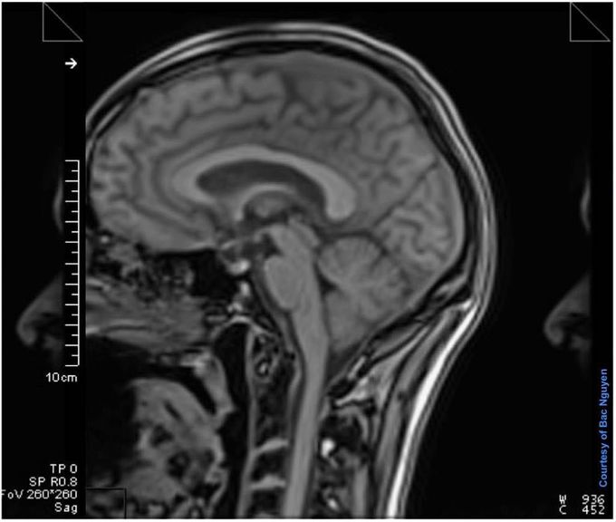 Is this the kind of situation where I need bigger screen or - MEDizzy