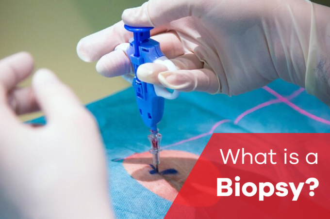 Biopsy - MEDizzy