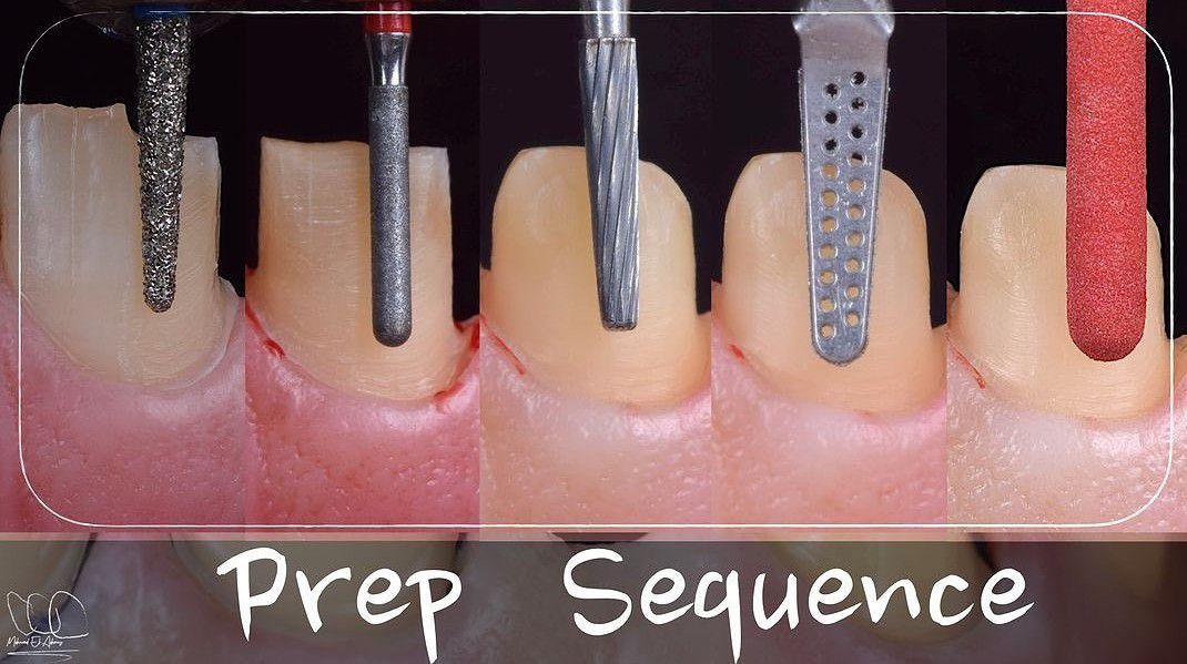 Prep Sequence - MEDizzy