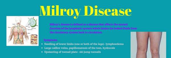 These are the symptoms of Milroy's syndrome - MEDizzy
