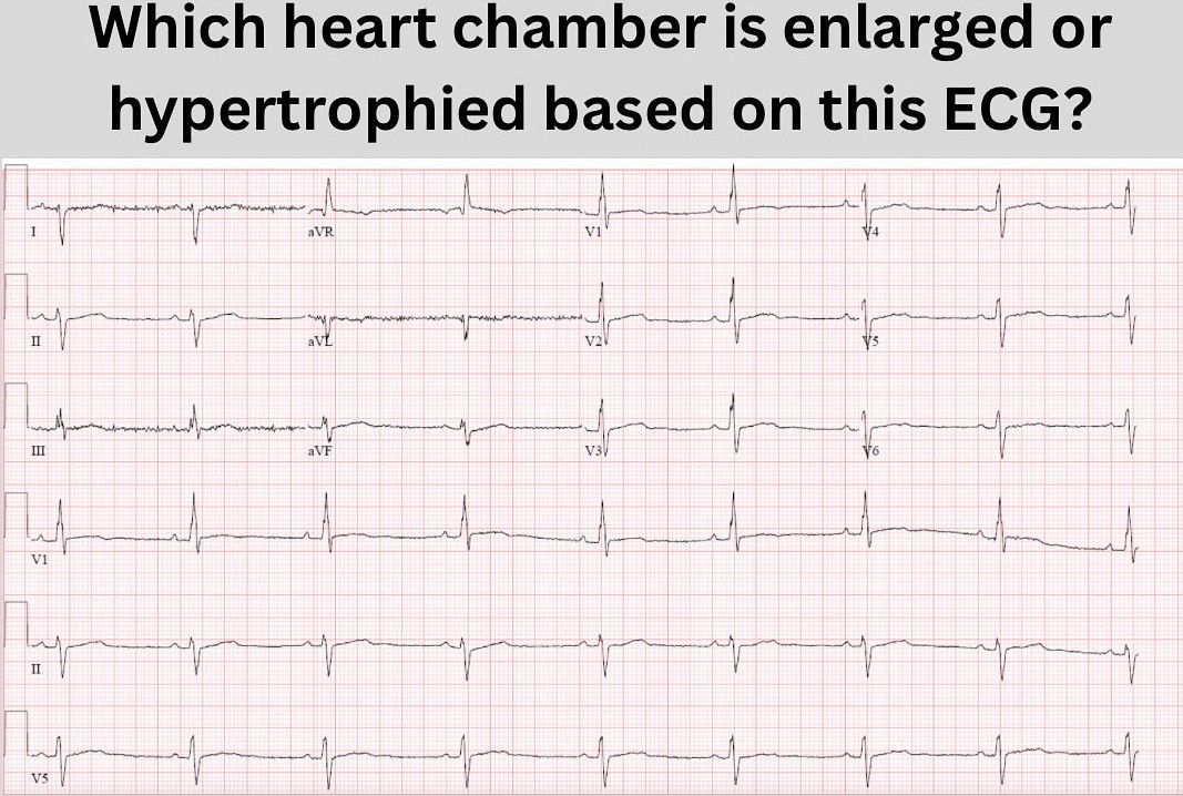 Identify the Chamber - MEDizzy