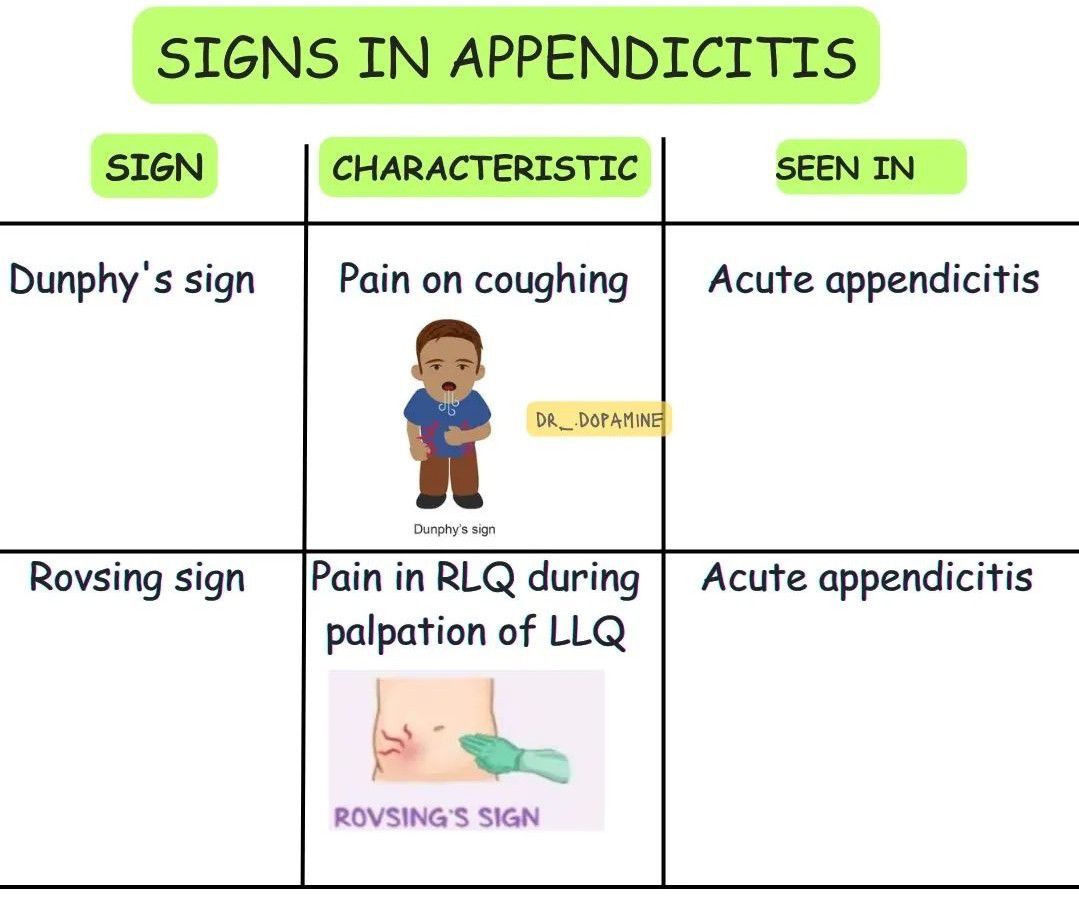 Sign For Appendicitis