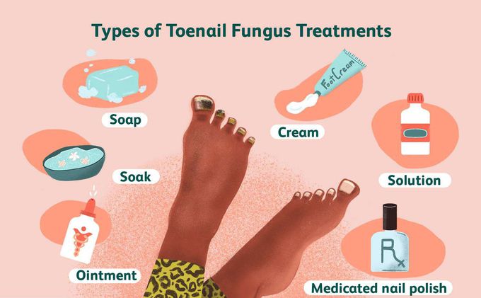 antifungal pills - MEDizzy