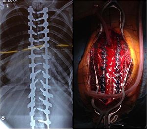Intraoperative (right) and postoperative (left) views of the - MEDizzy
