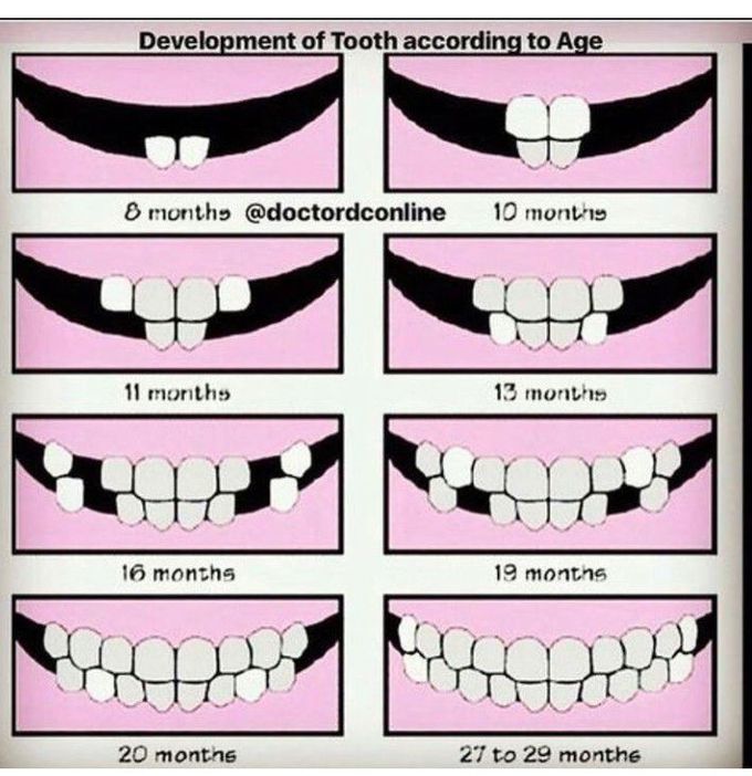 Eruption of Deciduous Teeth - MEDizzy