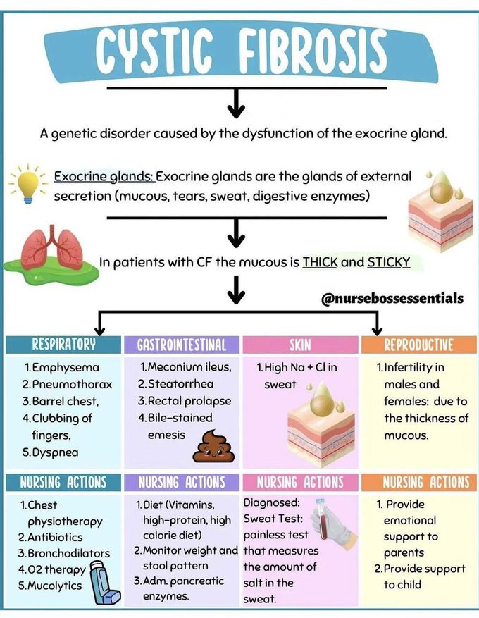 Barrel Chest Cystic Fibrosis