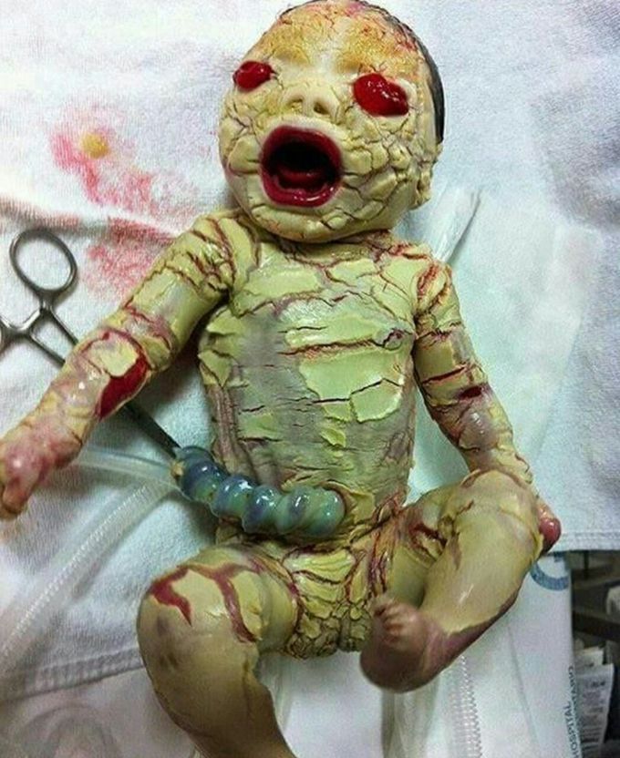 Any comment - MEDizzy