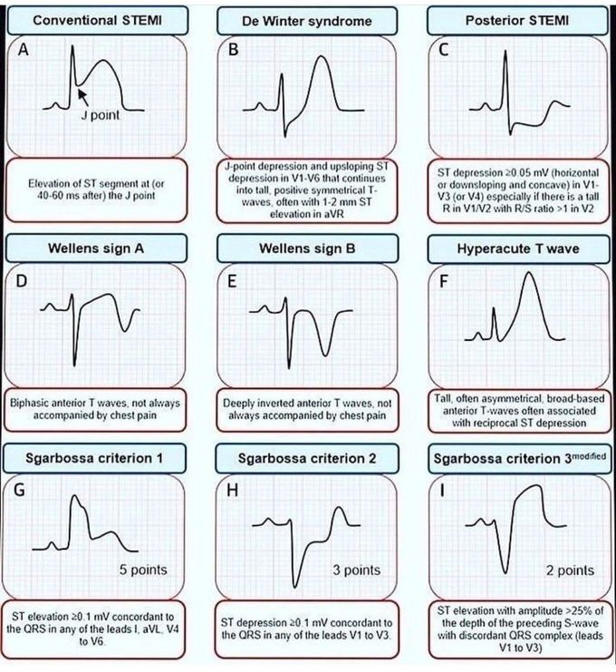 ECG Review - MEDizzy