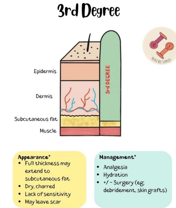 3rd Degree Burn - MEDizzy