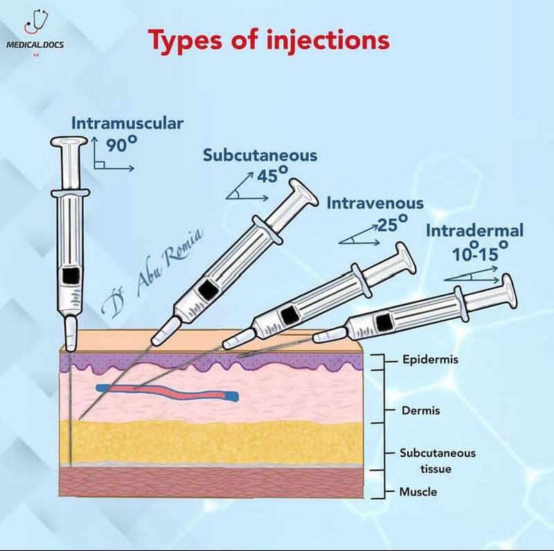 Intravenous Injection Angle