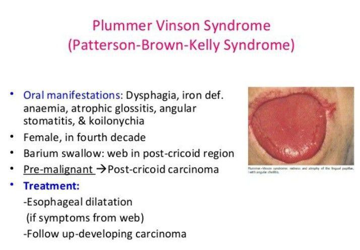 Paterson Kelly Syndrome