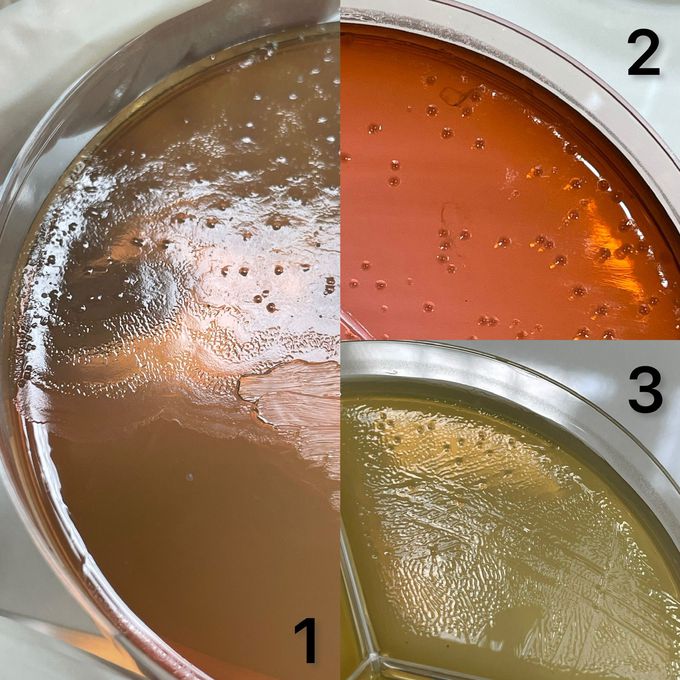 The colonies of Proteus spp. - MEDizzy