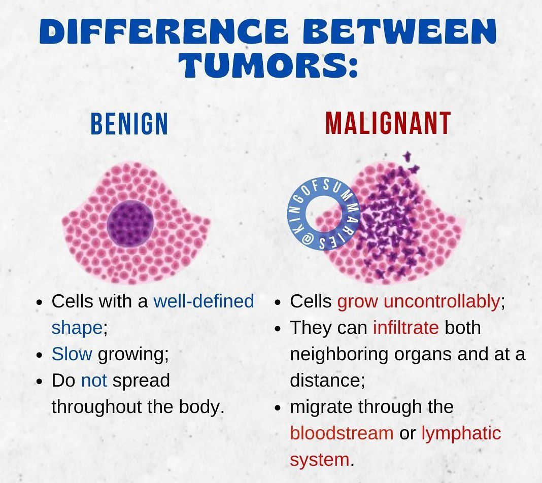Benign And Malignant Tumors What Is The Difference Comparison Between