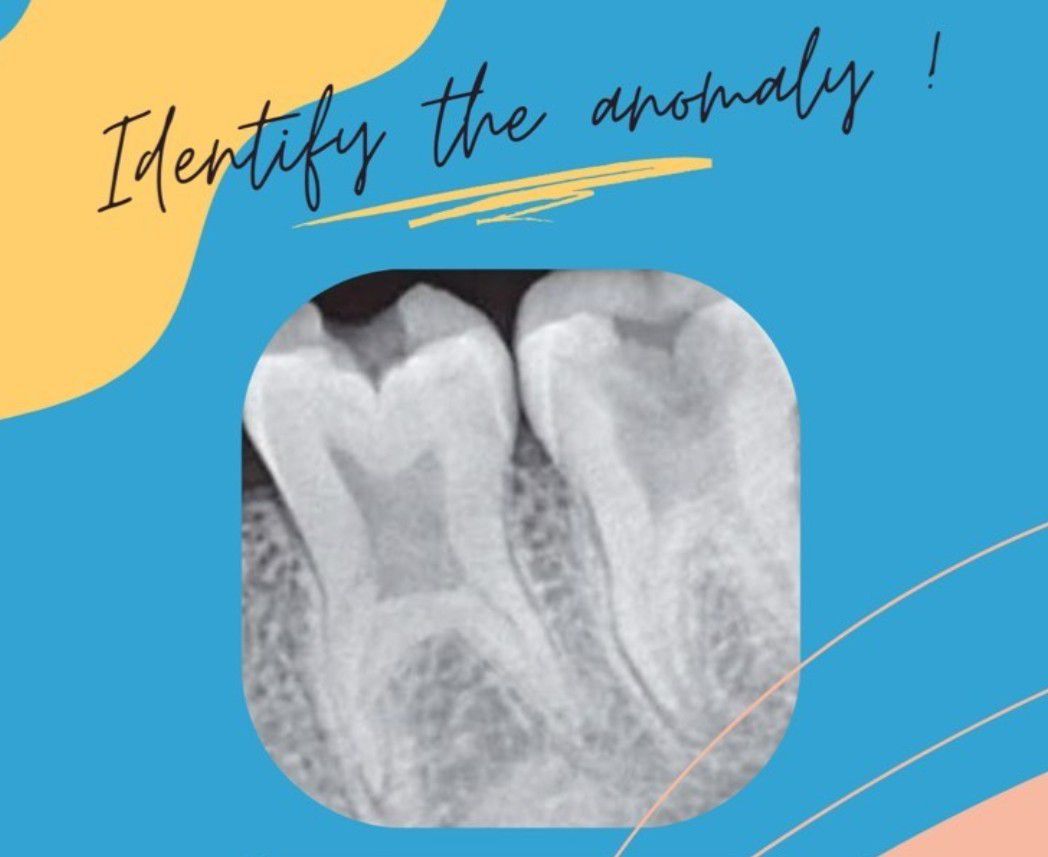 Identify the Anomaly -II - MEDizzy