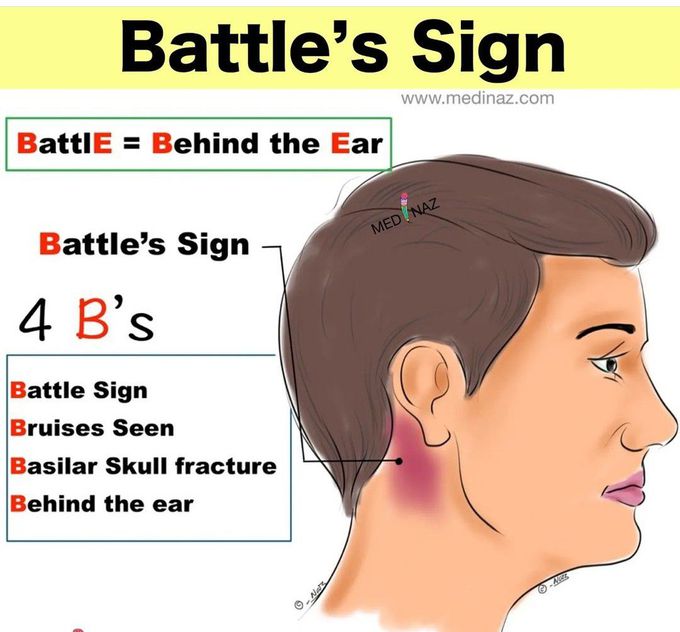 Battle s Sign MEDizzy