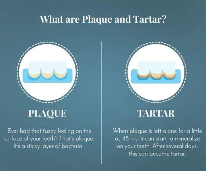 Plaque vs Tartar - MEDizzy