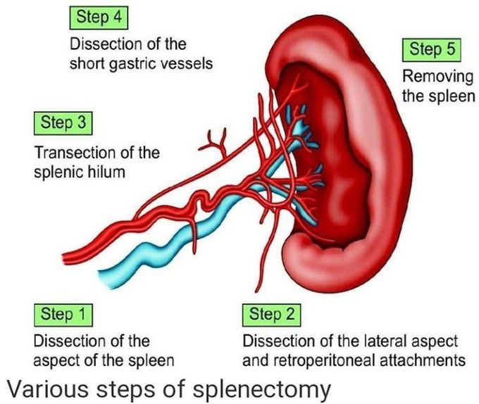 general-surgery-medizzy