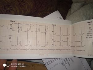 What is Dx - MEDizzy