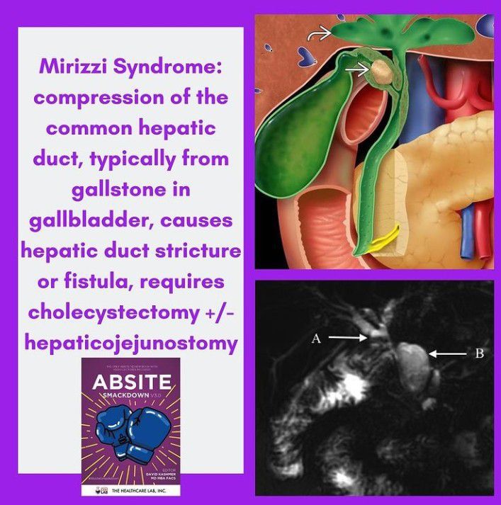 General surgery - MEDizzy