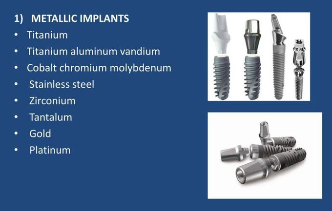 Implants - Materials - MEDizzy