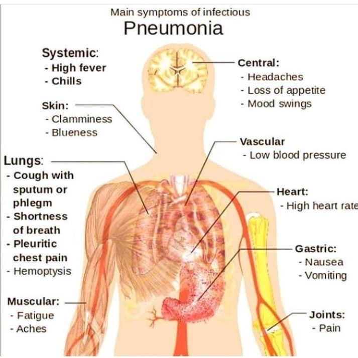 Synptoms of infectious pneumonia - MEDizzy