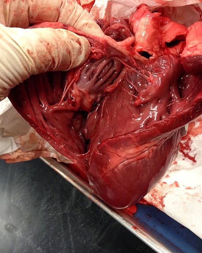 Heart dissection - MEDizzy