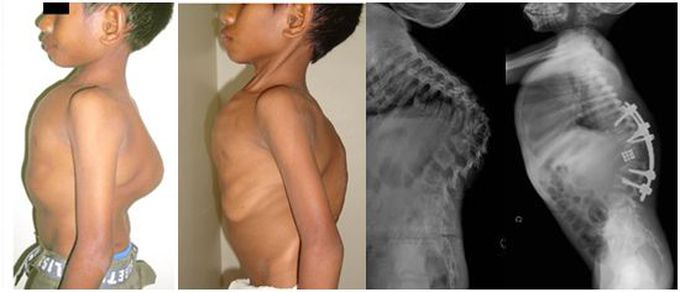 What's the name of this deformity?? - MEDizzy