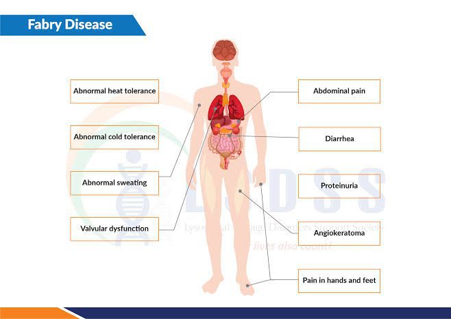 Symptoms of fabry's disease - MEDizzy