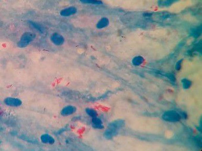 Post number 1282013 - MEDizzy