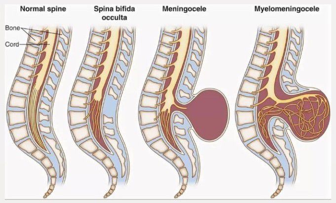 Spinal Pathologies - MEDizzy