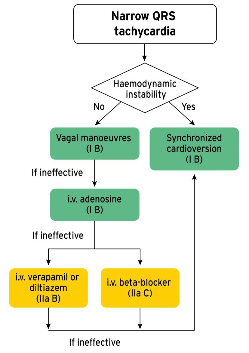 Narrow QRS tachycardia treatment algoritm - MEDizzy