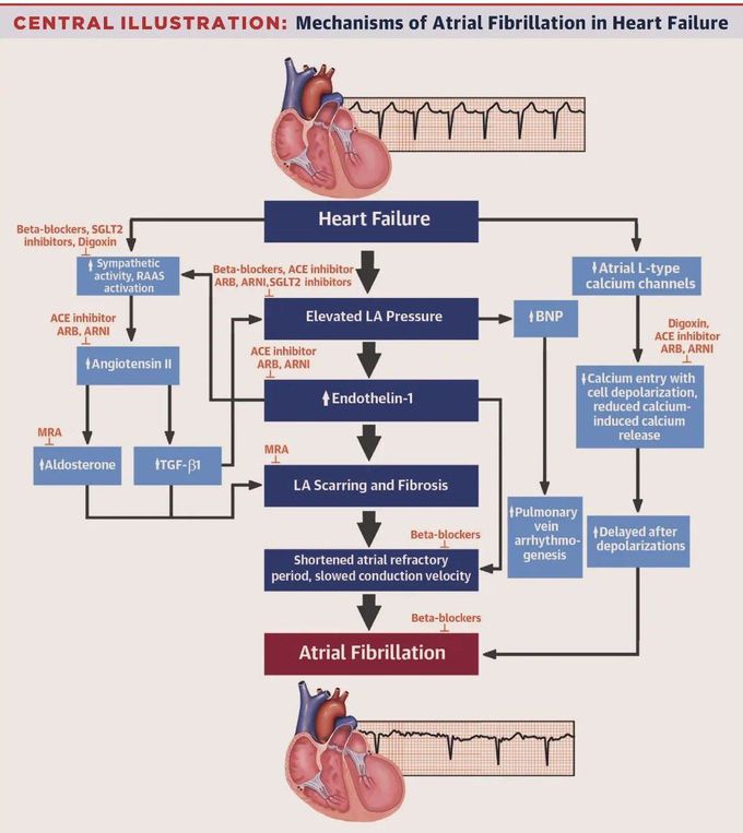 Mechanism Of A Fib MEDizzy