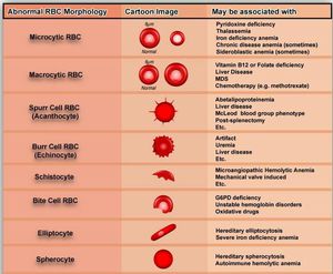 RBC abnormal shapes & diseases - MEDizzy