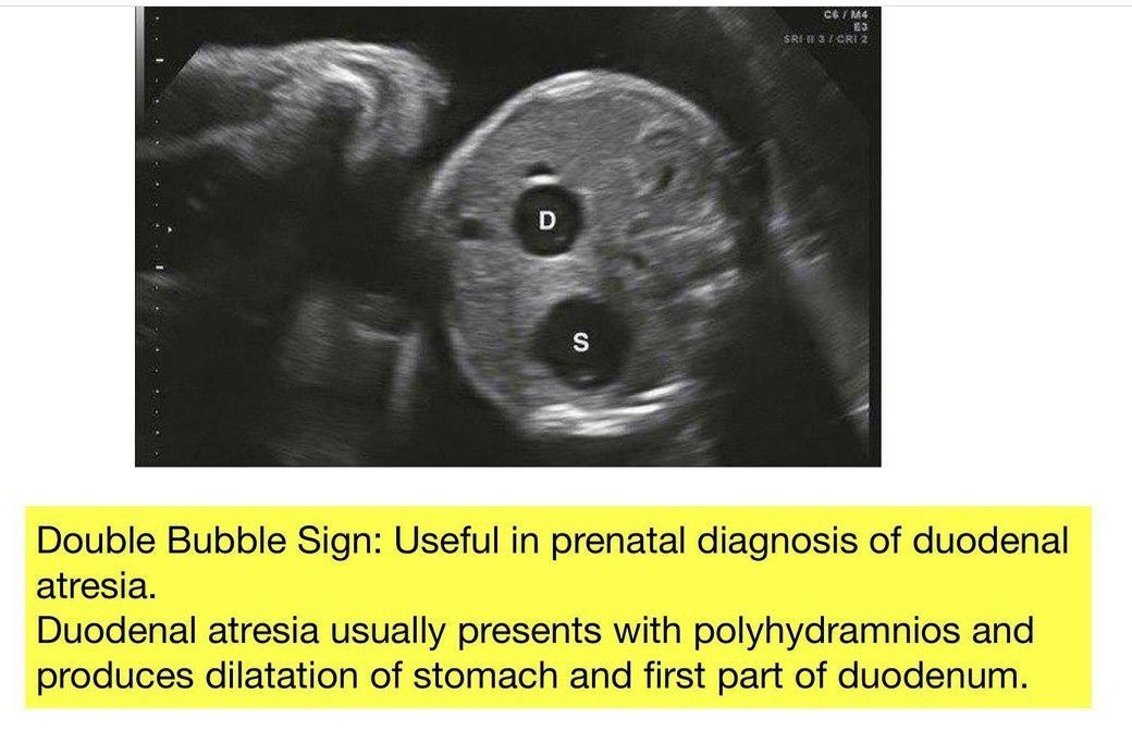 Double Bubble Sign - MEDizzy
