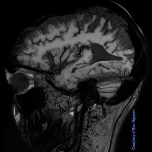 Have a nice upcoming weekend :)#s_mri #neuro #siemens #mri - MEDizzy