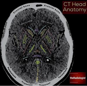 CT head’s anatomy - MEDizzy