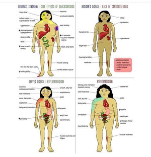 The difference.. - MEDizzy