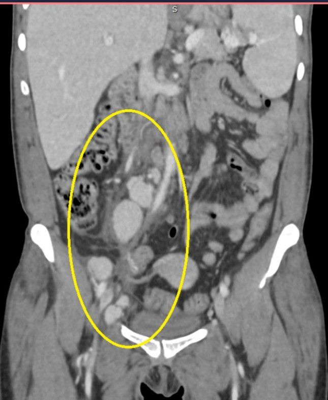 General surgery - MEDizzy