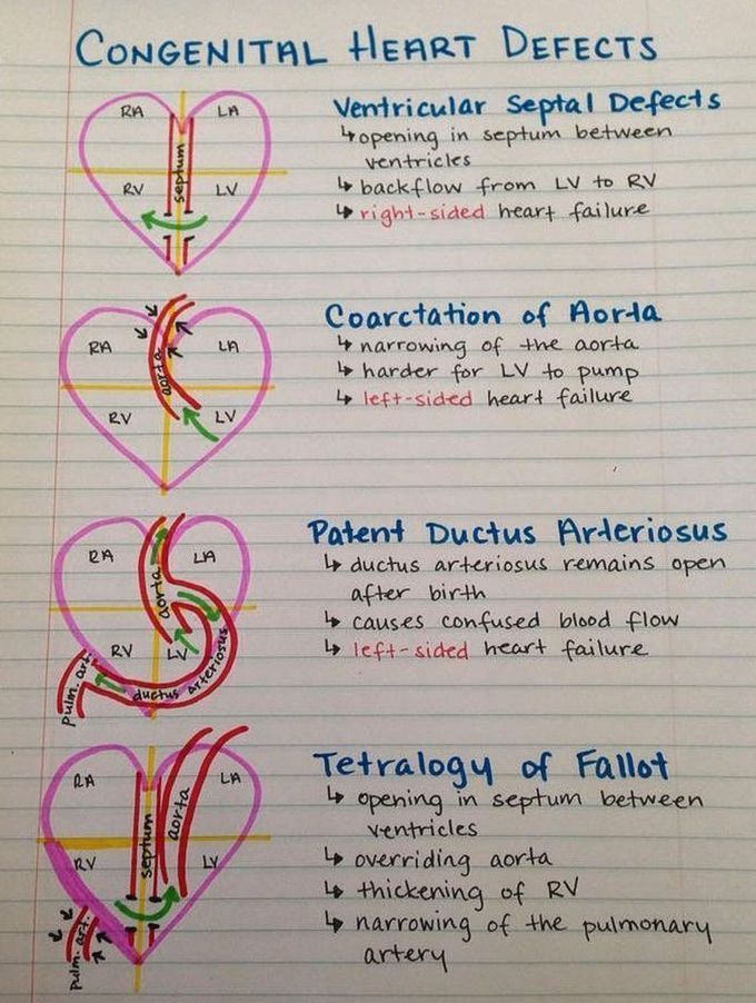 CHD (Congenital Heart Diseases ) - MEDizzy